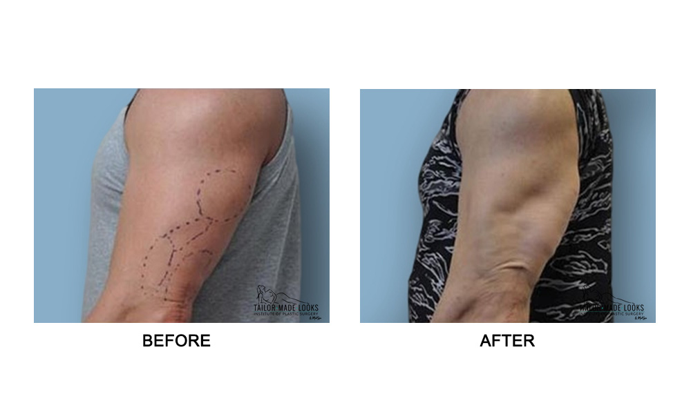 View Patient Details | Tailor Made Looks Institute of Plastic Surgery