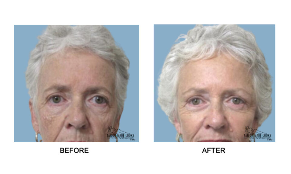 View Patient Details | Tailor Made Looks Institute of Plastic Surgery