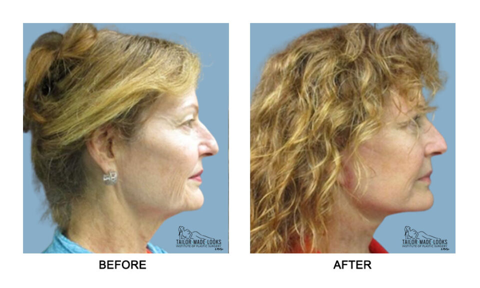 View Patient Details | Tailor Made Looks Institute of Plastic Surgery