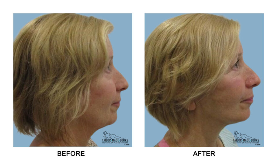 View Patient Details | Tailor Made Looks Institute of Plastic Surgery