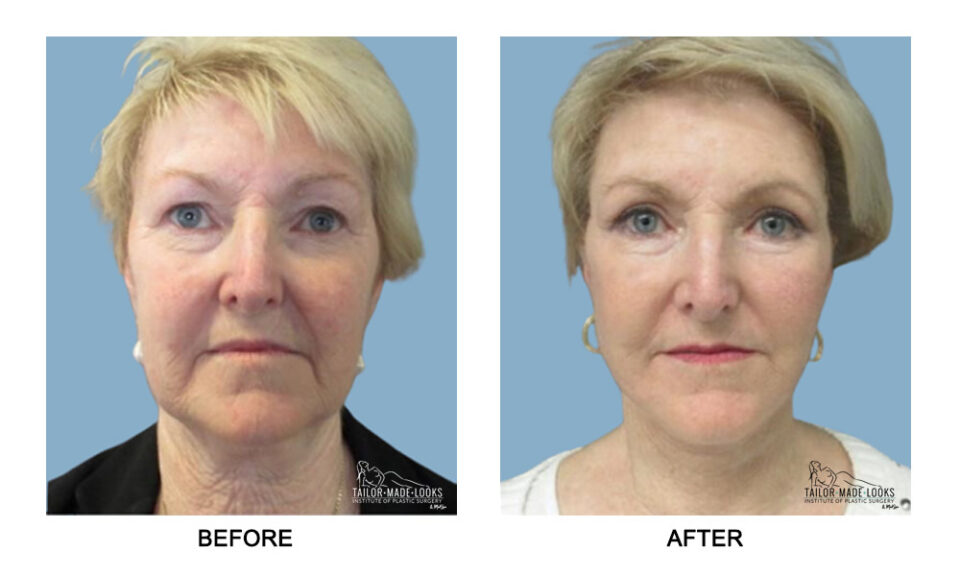 View Patient Details | Tailor Made Looks Institute of Plastic Surgery