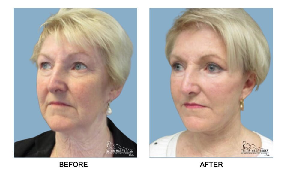 View Patient Details | Tailor Made Looks Institute of Plastic Surgery