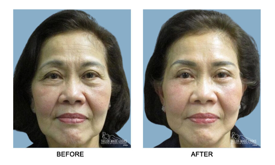 View Patient Details | Tailor Made Looks Institute of Plastic Surgery