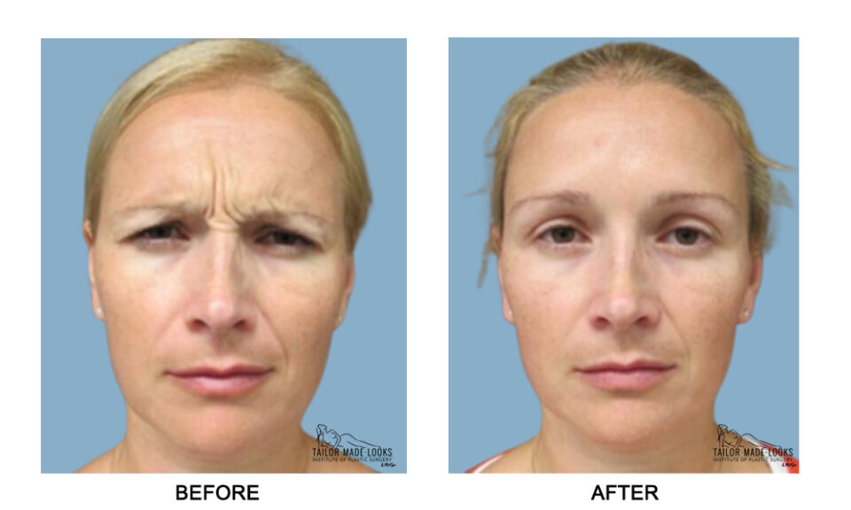 View Patient Details | Tailor Made Looks Institute of Plastic Surgery