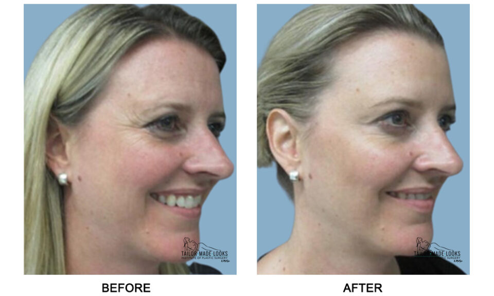 View Patient Details | Tailor Made Looks Institute of Plastic Surgery