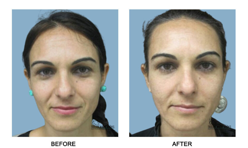 View Patient Details | Tailor Made Looks Institute of Plastic Surgery