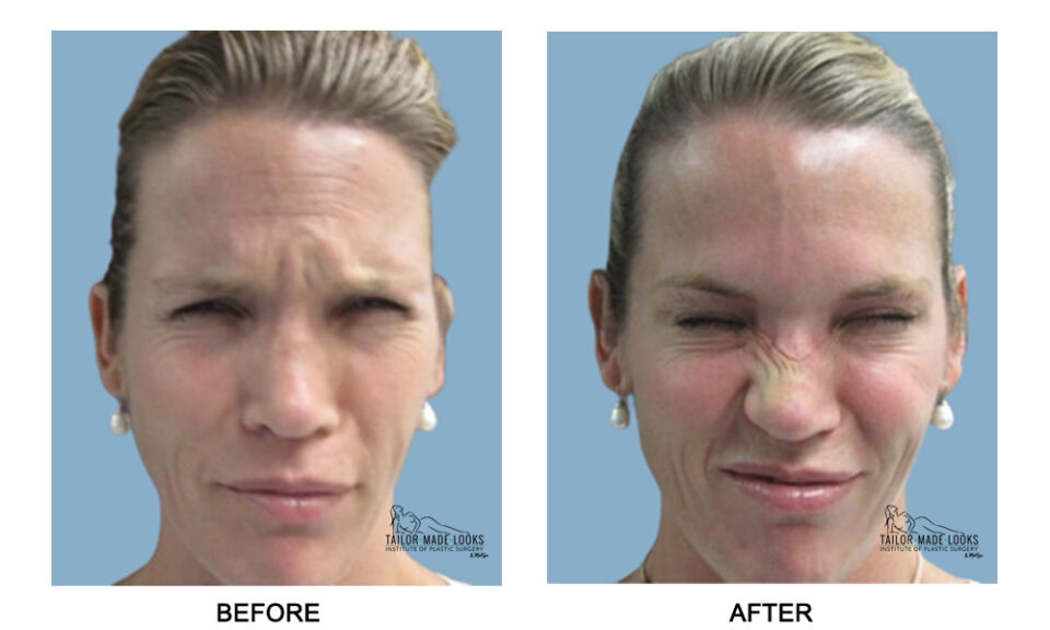 View Patient Details | Tailor Made Looks Institute of Plastic Surgery