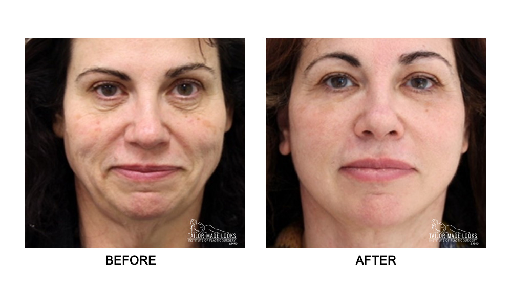 View Patient Details | Tailor Made Looks Institute of Plastic Surgery
