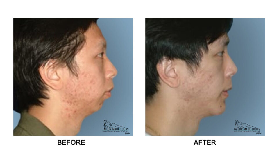 View Patient Details | Tailor Made Looks Institute of Plastic Surgery