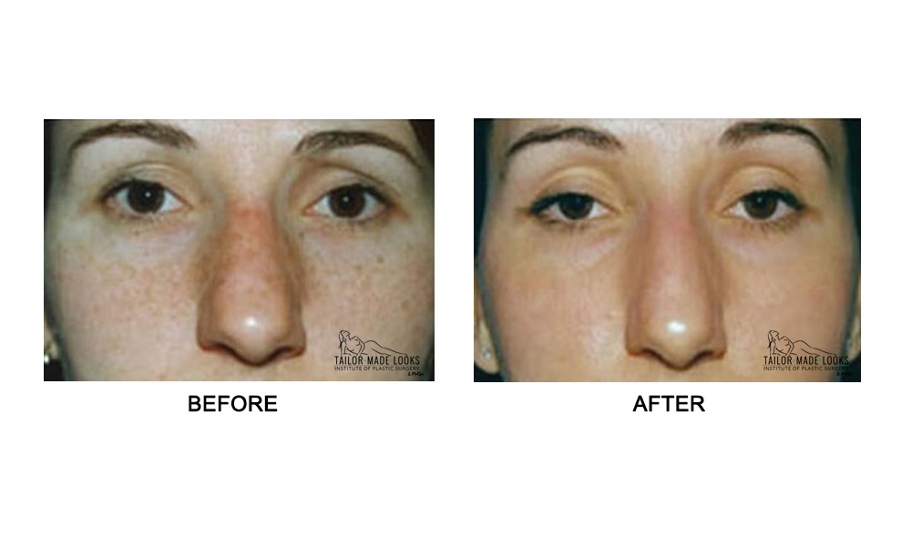 View Patient Details | Tailor Made Looks Institute of Plastic Surgery