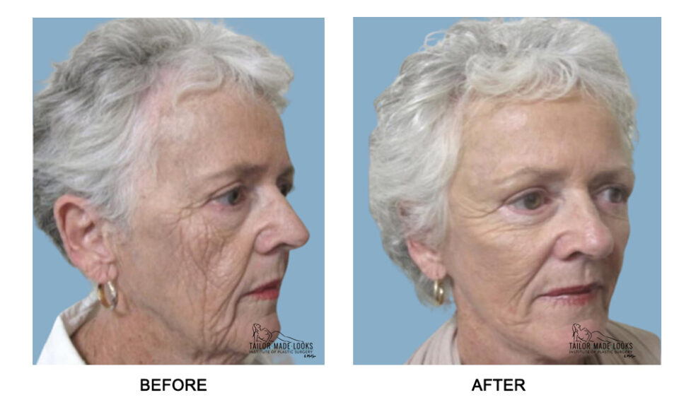 View Patient Details | Tailor Made Looks Institute of Plastic Surgery