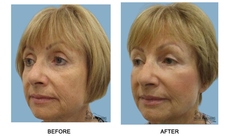 View Patient Details | Tailor Made Looks Institute of Plastic Surgery