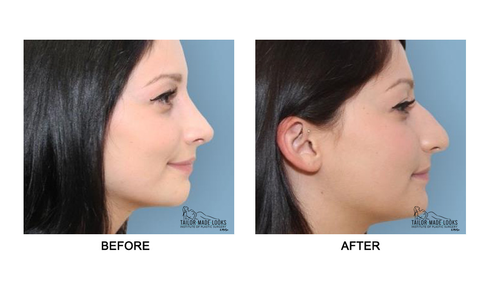 View Patient Details | Tailor Made Looks Institute of Plastic Surgery